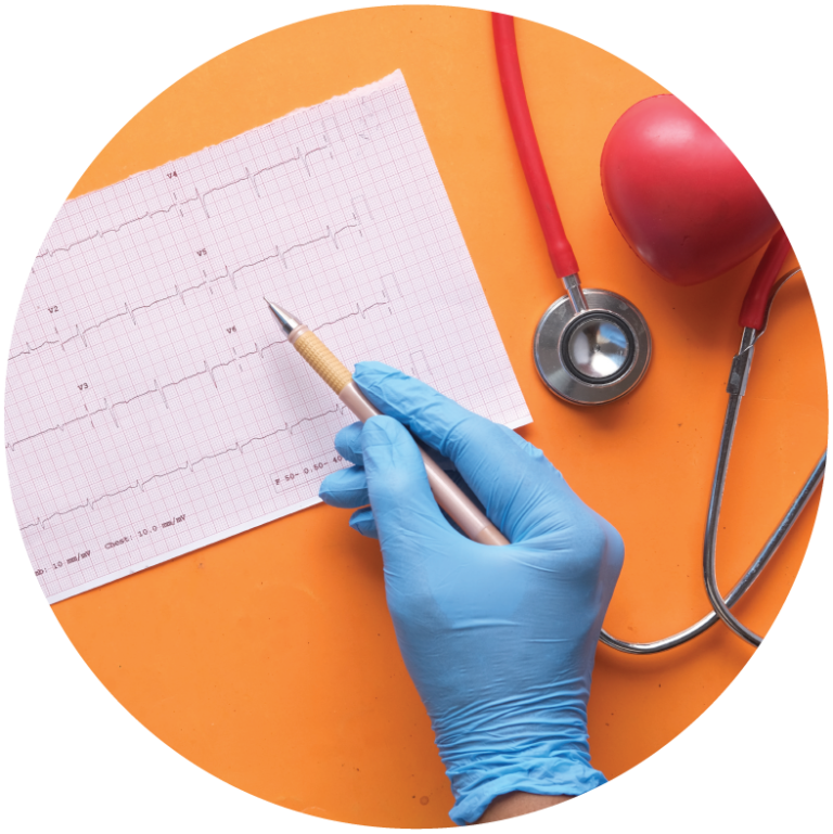 Atriale fibrillatie - Rhode Medical Center